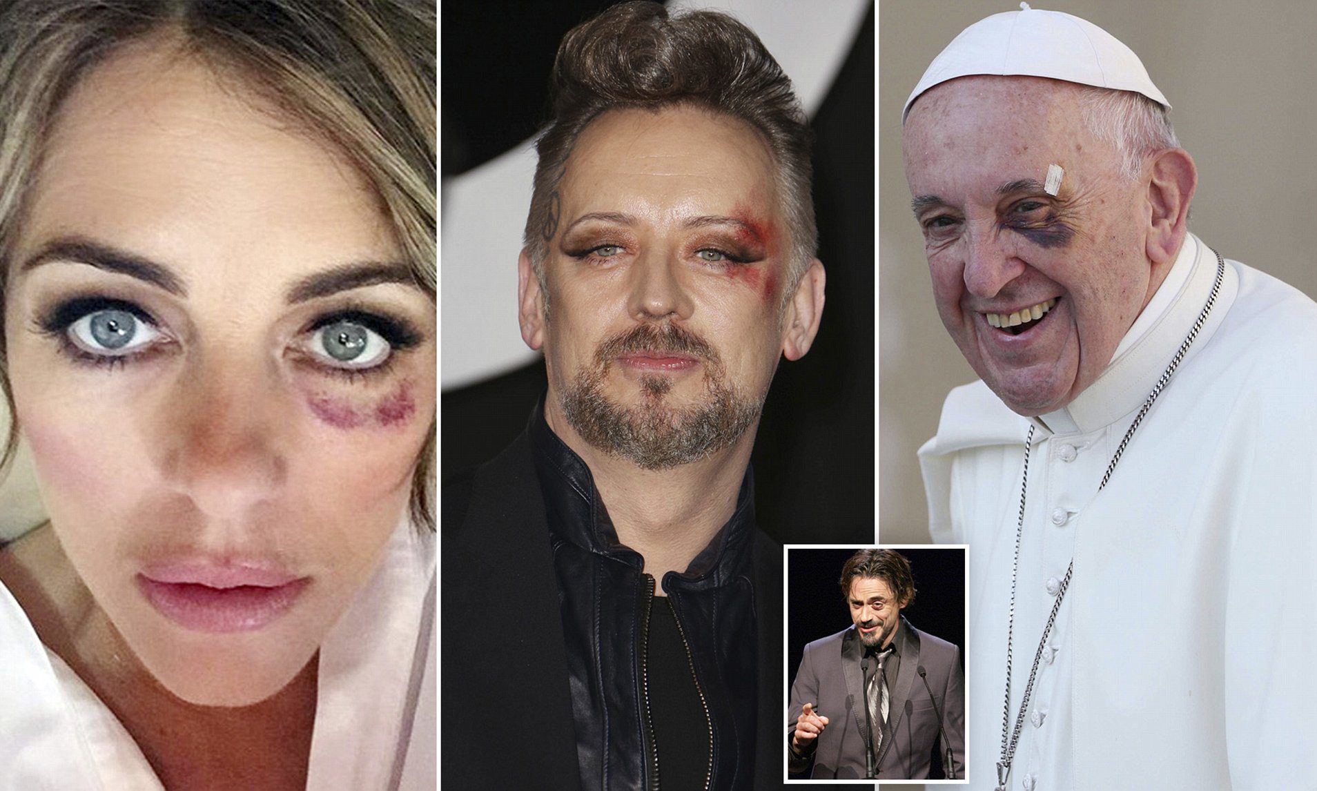 Just What Exactly Is 'The Black Eye Club,' And Why Are So Many ...